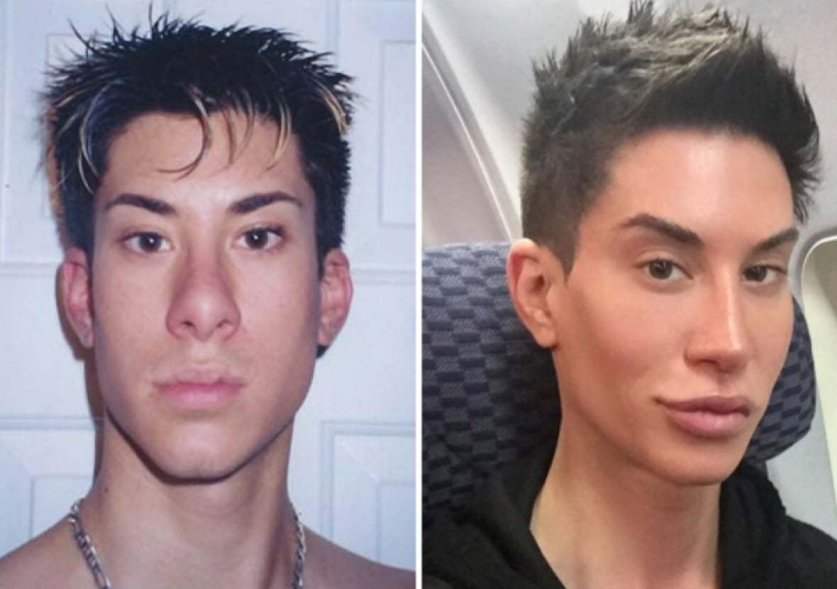 Justin Jedlica l'uomo che ha speso più di 100.000 dollari per ...